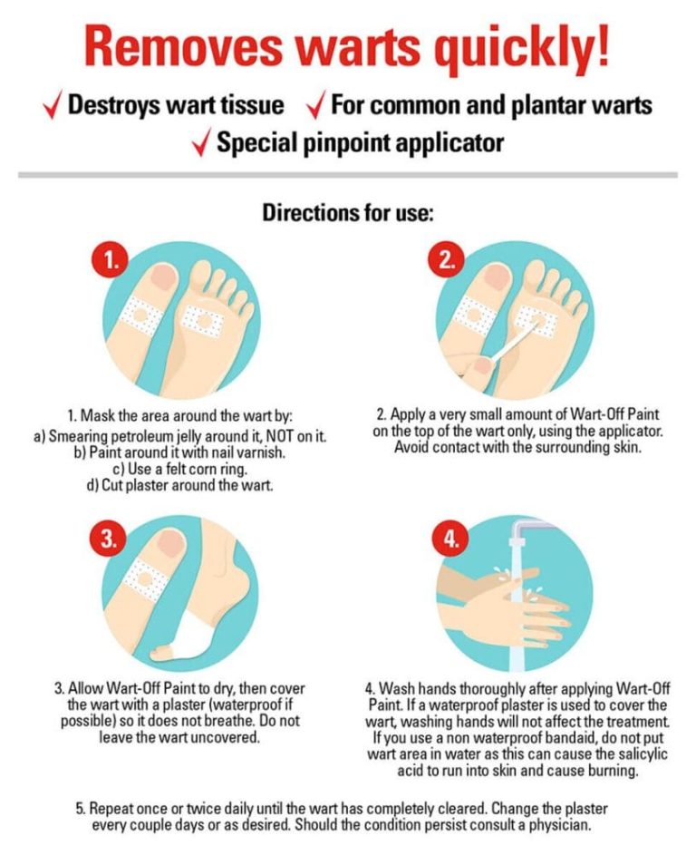 Wart Off Paint – Treatment For Common And Plantar Warts Verruca ...